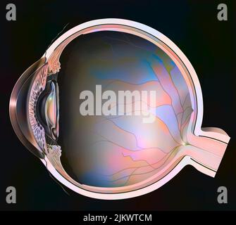 Eye (secondary cataract): clouding of the posterior lens capsule Stock ...