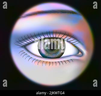 Eye: placement of an intraocular implant for treatment of cataracts ...