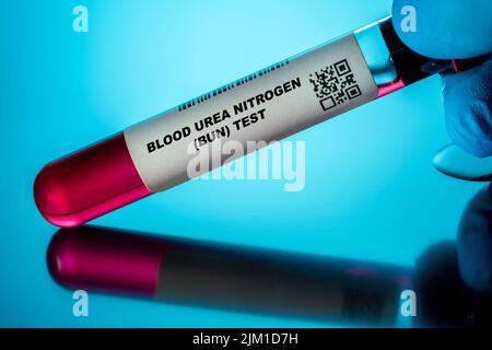 Urea nitrogen test Stock Photo - Alamy