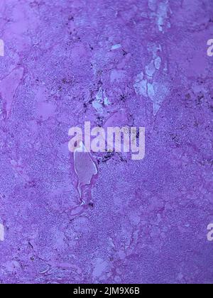 Lung tissue histology in the mobile microscopic view. H and E staining ...