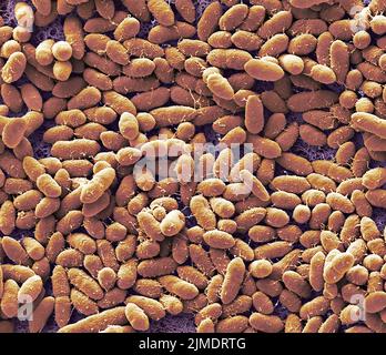 Human faecal material. Coloured scanning electron micrograph (SEM) of ...