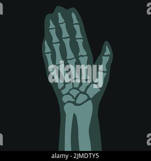 Roentgenogram of hand, isolated scan of limb, palm with fingers and ...