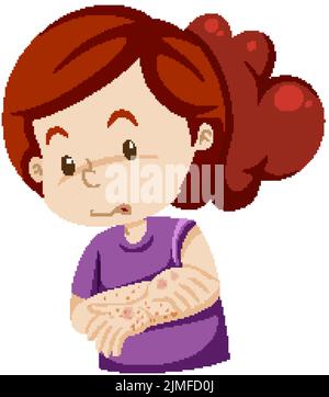 Cartoon character with skin rashes symptoms illustration Stock Vector ...