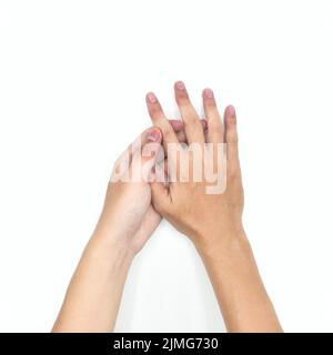 Cyanotic hands or peripheral cyanosis or blue hands at Southeast Asian ...