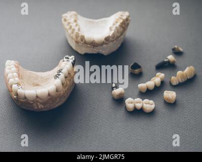 dental prosthesis jaws dentures crowns forceps Stock Photo - Alamy