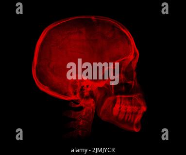 Human skull. Red X-ray image on white background Stock Photo - Alamy