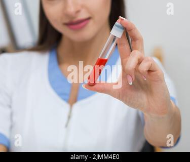 Hand holding blood sample vial in laboratory tube test Stock Photo - Alamy