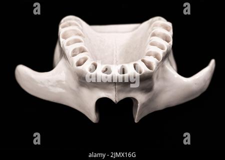 Upper human jaw without teeth model medical implant isolated on black ...