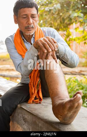 Leprosy patients survive on the fringes of society, forming their own ...