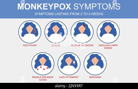 Monkeypox virus sign and symptoms infographic illustration Stock Vector ...