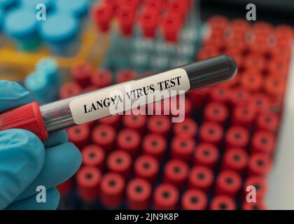 langya virus test tube in microbiological laboratory Stock Photo - Alamy