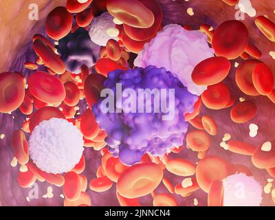 Blood cells with circulating tumor cells, illustration Stock Photo - Alamy