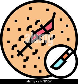 surgical excision mole removal color icon vector illustration Stock ...