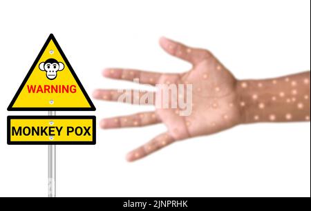 monkey pox warning sign board on blur sky background. health care ...