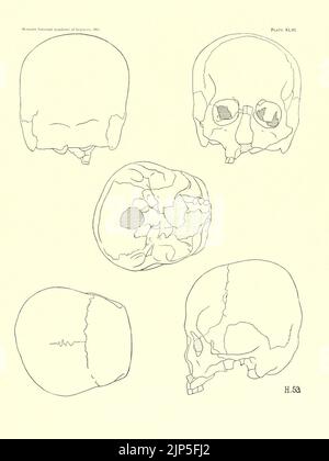 The human bones of the Hemenway collection in the United States Army ...