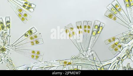 Licmophora sp. algae, marine and freshwater diatom under microscopic ...