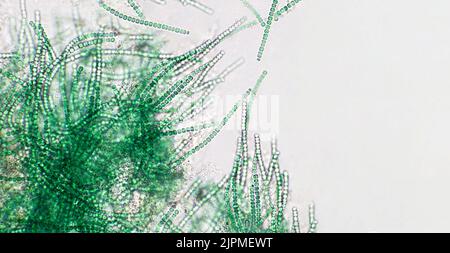 Blue green algae under microscopic view, cyanobacteria Stock Photo - Alamy