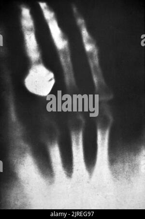The first Roentgen X-ray tube Stock Photo - Alamy