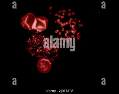 Chromosomes under fluorescence microscope, red colored Human ...