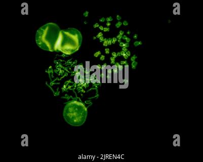 Chromosomes under fluorescence microscope, green colored Human ...