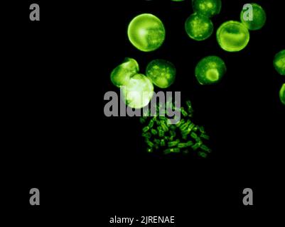 Chromosomes under fluorescence microscope, green colored Human ...
