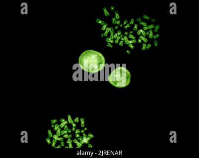 Chromosomes under fluorescence microscope, green colored Human ...