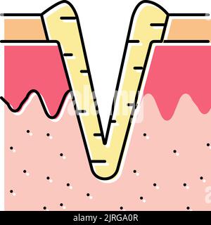 ice pick acne scar line icon vector illustration Stock Vector Image ...