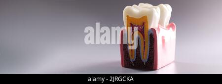 Mock tooth in section, educational model of tooth, anatomy of human ...