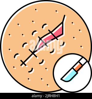 surgical excision mole removal color icon vector illustration Stock ...