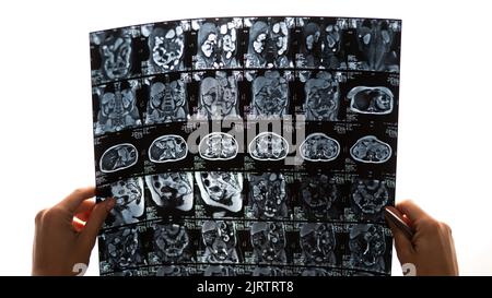 Female doctor explaining mri of internal organs to female patient Stock ...