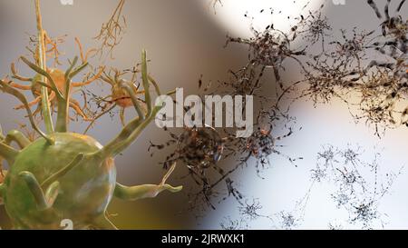 Mild Traumatic Brain Injury, damaged neurons, alzheimers disease ...