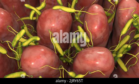 Cholera bacteria in human intestine, illustration Stock Photo - Alamy