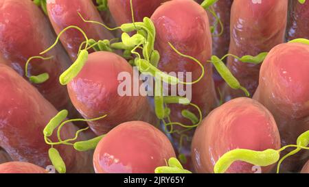Cholera bacteria in human intestine, illustration Stock Photo - Alamy