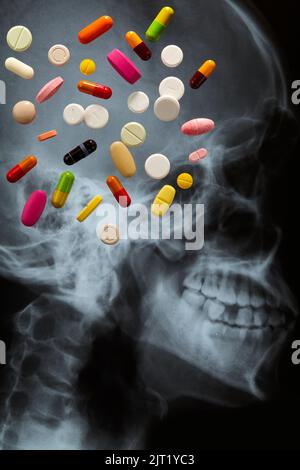 Drug capsule, X-ray Stock Photo - Alamy
