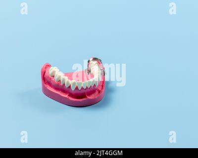 Layout of the human jaw and the rubber dam clamp forceps with the clamp ...
