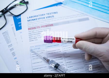 Blood collection tubes and data sheet on monkeypox test positive ...
