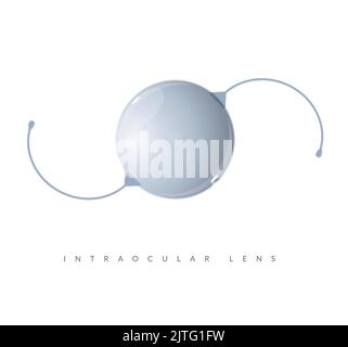 Human Eye - Cataract - Intraocular Lense- Illustration as EPS 10 File ...