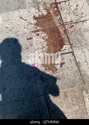 Human shadow and dark patch, Lyon, France Stock Photo - Alamy