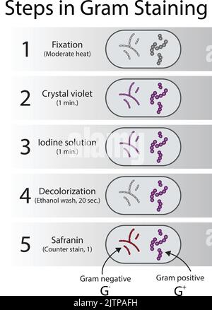 Diagram showing gram staining microbiology lab technique steps ...