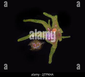 Amoeba Proteus, stained specimen Stock Photo - Alamy