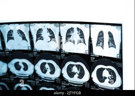 Female doctor explaining mri of internal organs to female patient Stock ...