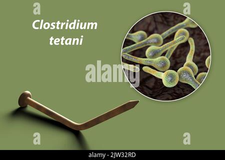 Transmission of tetanus bacteria. Conceptual illustration showing an ...