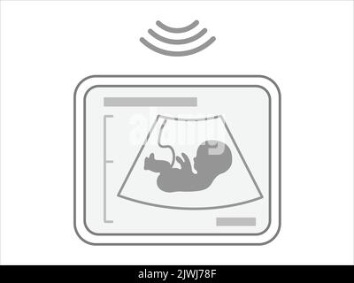 Ultrasound examination procedure. Baby in womb. Pregnancy and health of ...