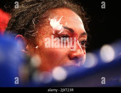 Boxer Baby Nansen looks on during her bout with Deanha Hobbs during the ...