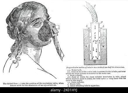 Ether inhaler. From The Lancet, London, 1847 Stock Photo - Alamy