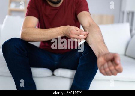 Human skin itching psoriasis man with itchy rash Stock Photo - Alamy