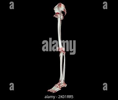 CT scan of lower extremity ,3D illustration of Femur bone , knee joint ...