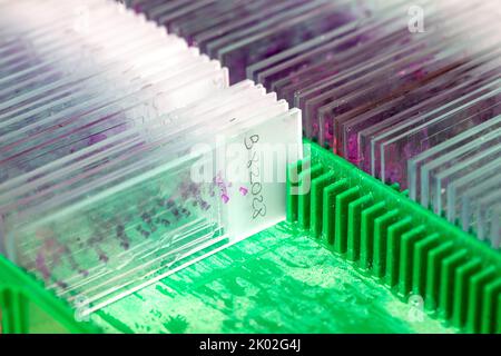 Box of stained tissue biopsy glass slides in pathology laboratory Stock ...