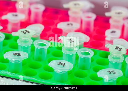 Rack of test tubes being used for DNA extraction using the spin column ...