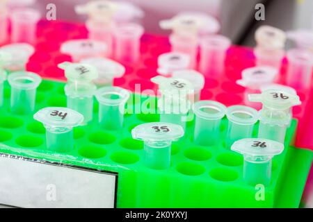 Rack of test tubes being used for DNA extraction using the spin column ...